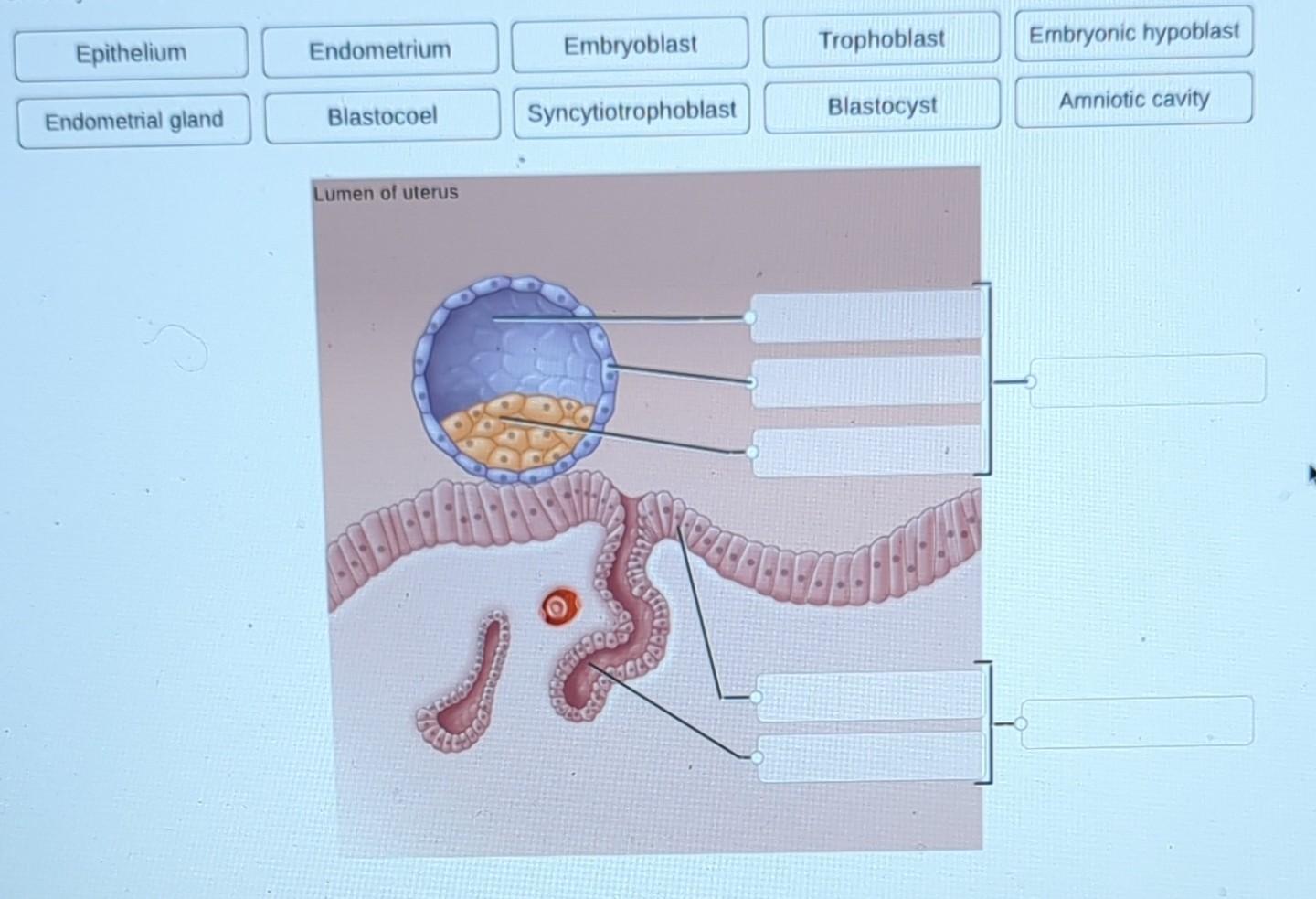 Solved Endometrial gland Blastocoel Syncytiotrophoblast | Chegg.com