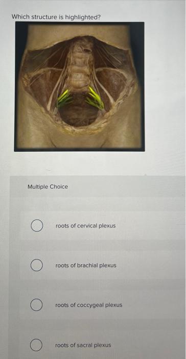 Solved Which structure is highlighted? Multiple Choice | Chegg.com