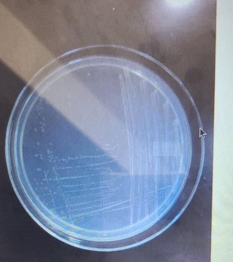 Solved This GSA plate was inoculated with a bacterial | Chegg.com
