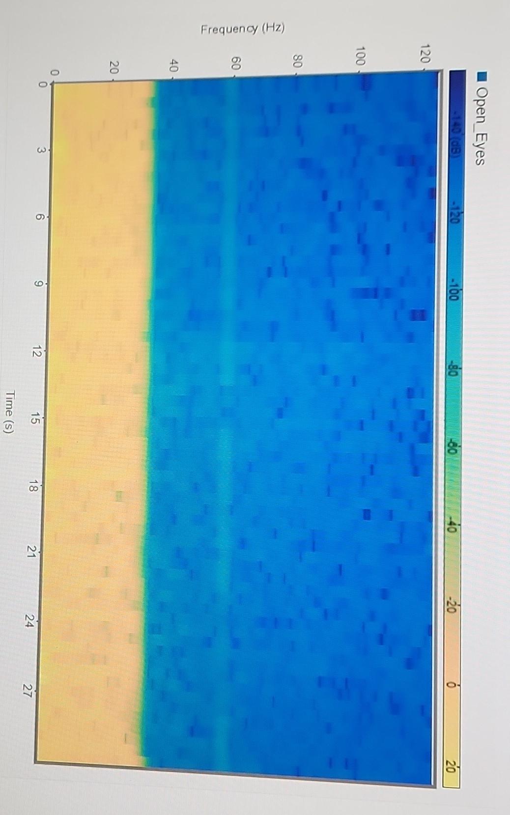 Open_EyesClose_EyesPower Spectrum (dB)Power Spe drum | Chegg.com