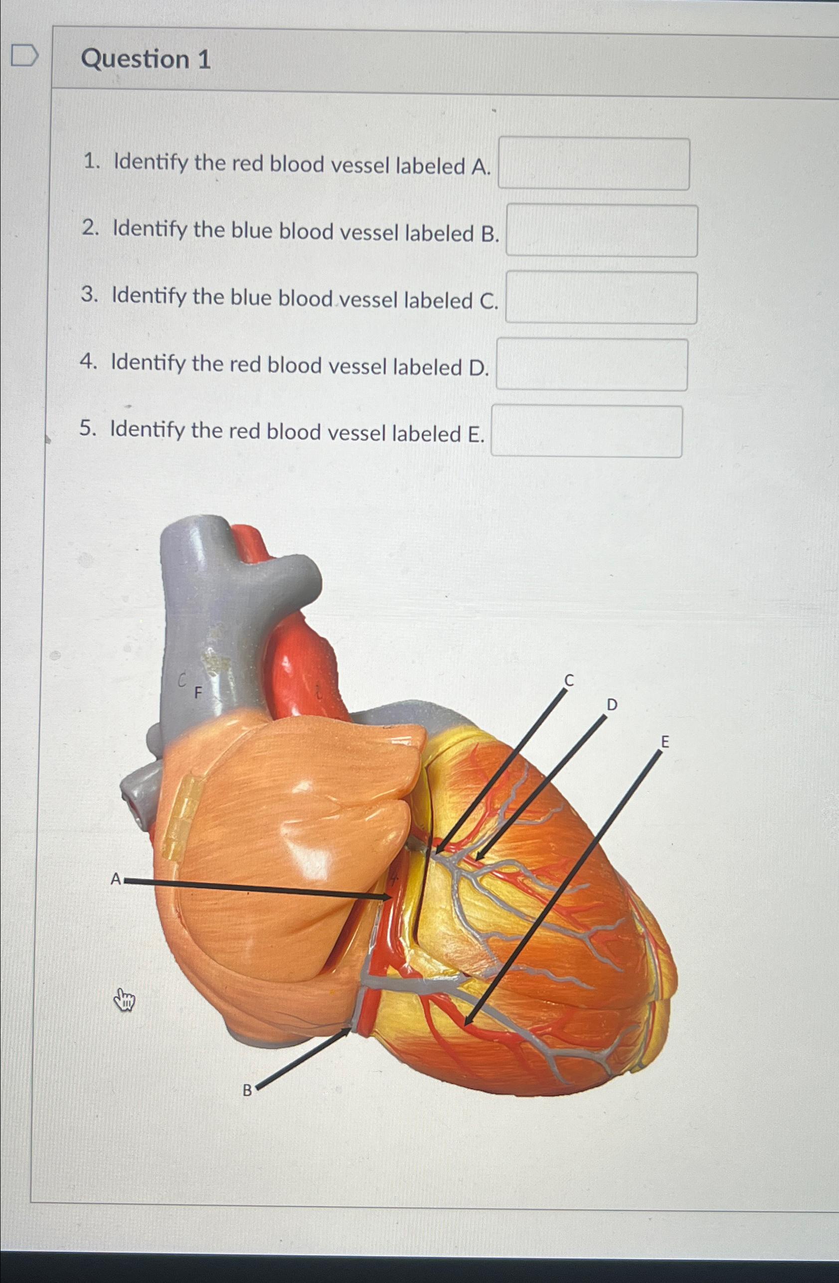 Solved Question 1Identify the red blood vessel labeled | Chegg.com