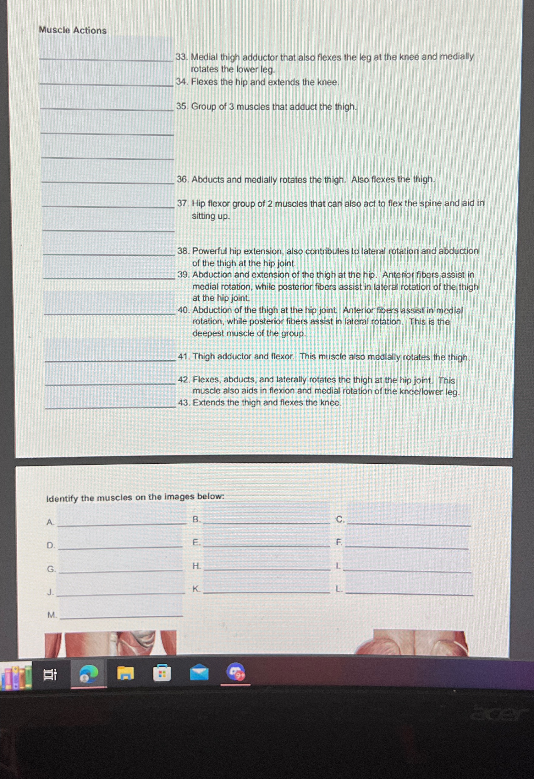 Solved Muscle Actions33. ﻿Medial thigh adductor that also | Chegg.com