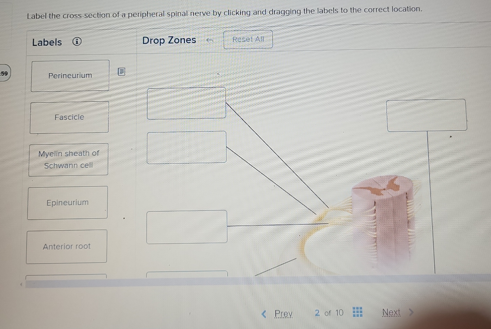 Solved Label the cross-section of a peripheral spinal nerve | Chegg.com