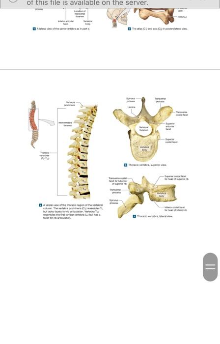 Solved Osteon Lacunae Central canal Lamellae Osteons SEM X | Chegg.com