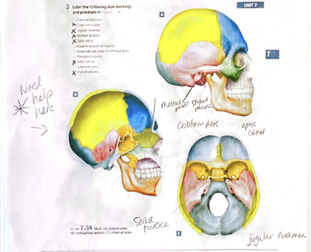 Solved Label the following skull markings | Chegg.com