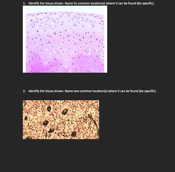 Solved Identify the tissue shown. Name two common | Chegg.com