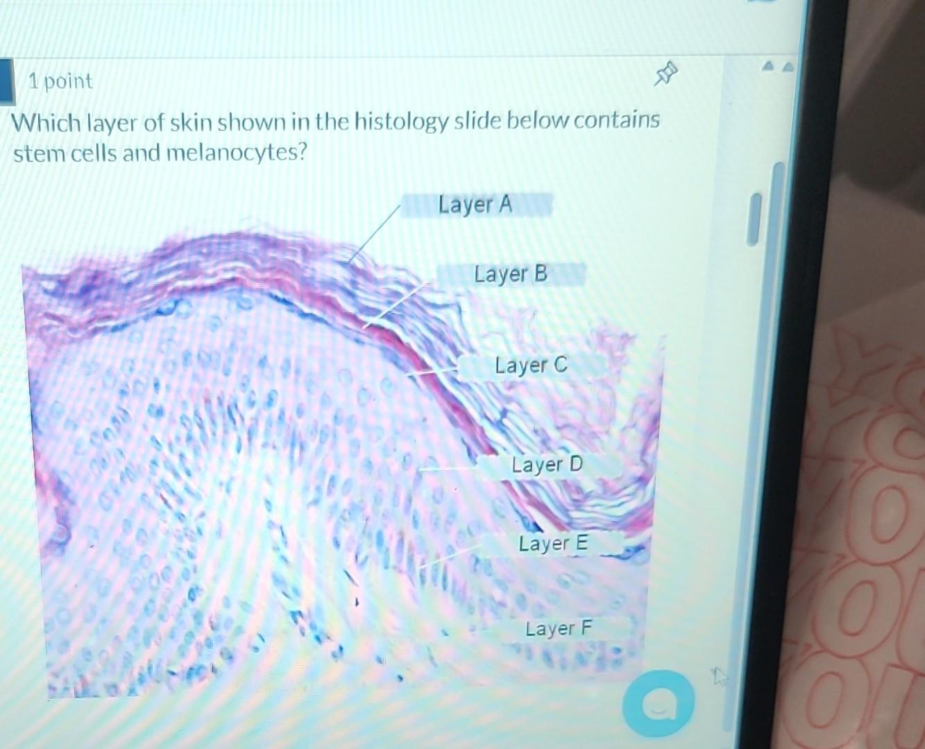 Solved Which layer of skin shown in the histology slide | Chegg.com