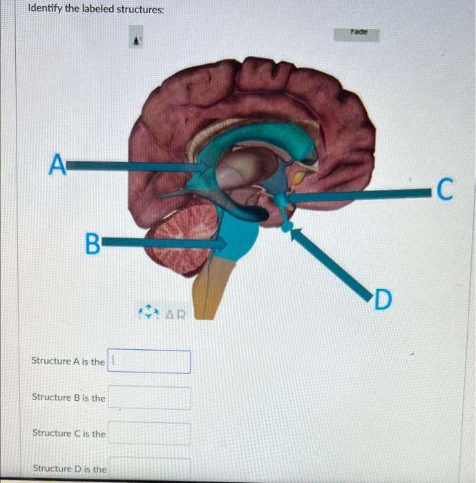 Solved Identify the labeled structures: A- B- Structure A is | Chegg.com