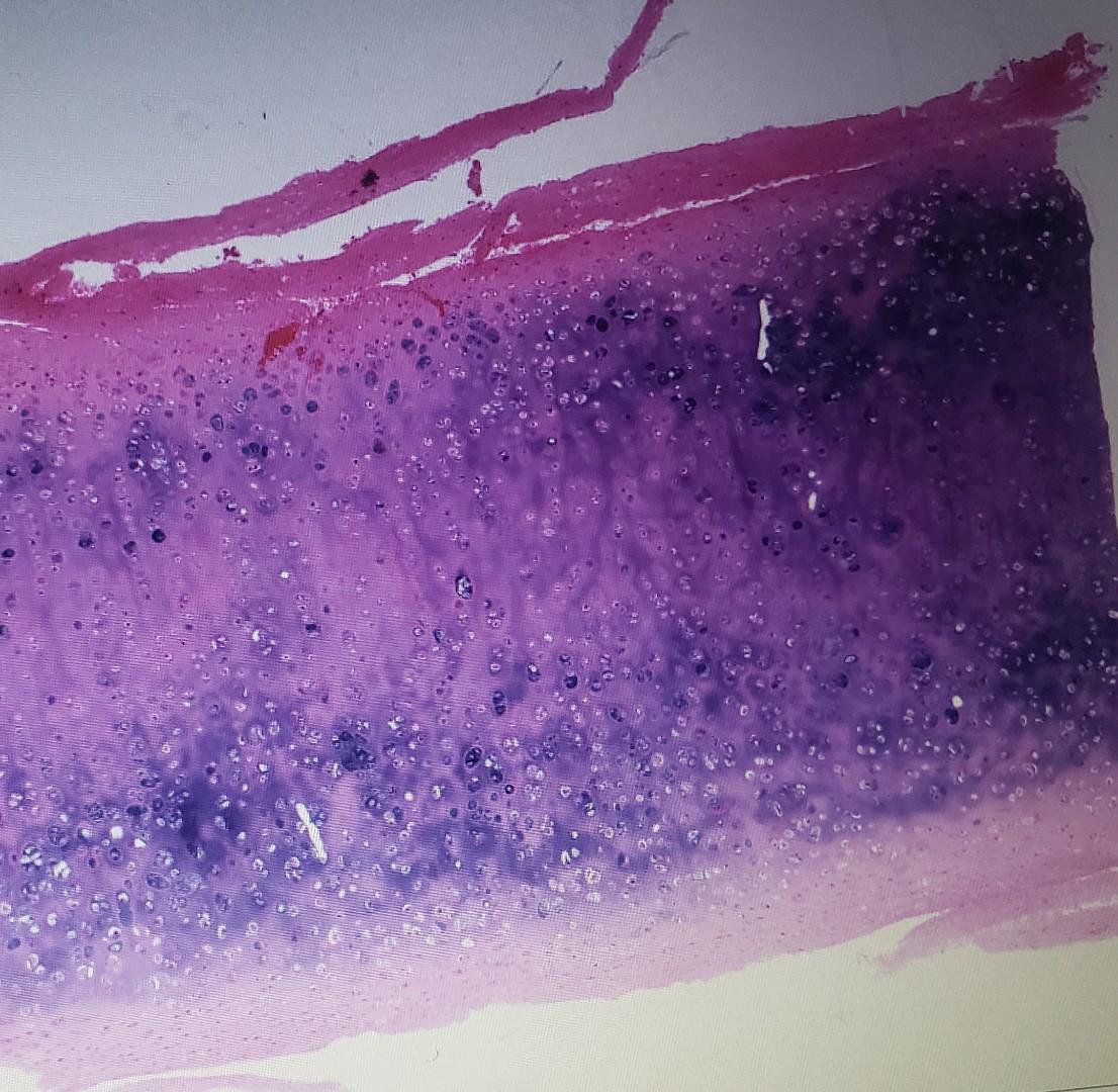 Solved In virtual microscope, go to the ‘Cartilage, Bone & | Chegg.com