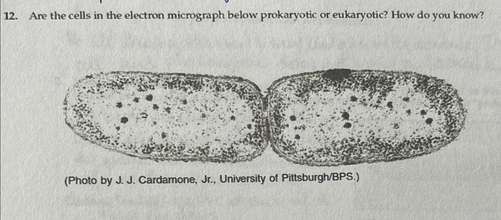 Solved Are the cells in the electron micrograph below | Chegg.com