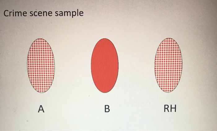 Solved Blood Typing: how to read Blood Type Reactions w/ | Chegg.com