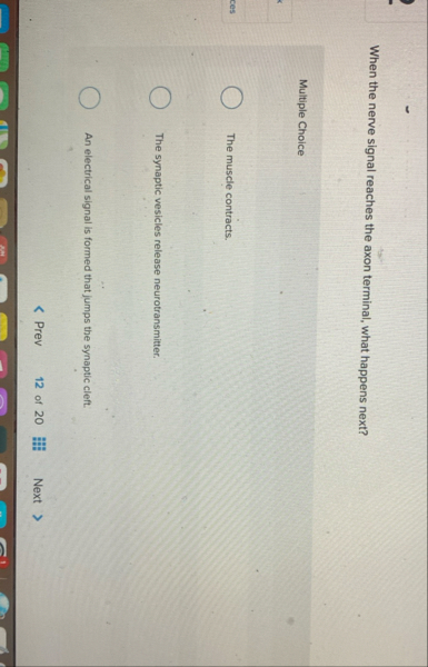 Solved When the nerve signal reaches the axon terminal, what | Chegg.com