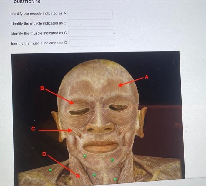 Solved QUESTION 1 Identify the muscle indicated as A | Chegg.com Solved QUESTION 1 Identify the muscle indicated as A | Chegg.com
