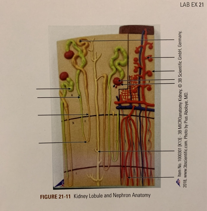 Solved FIGURE 21-11 Kidney Lobule and Nephron Anatomy Item | Chegg.com