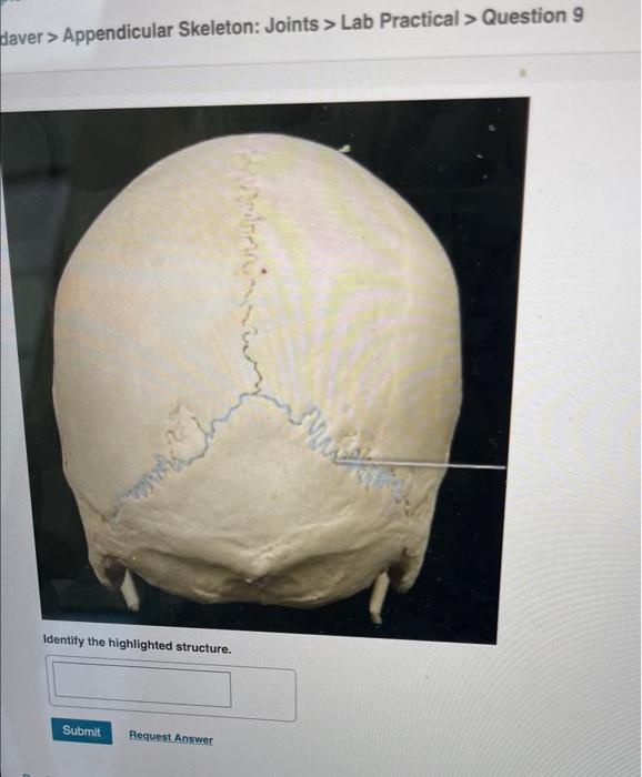 L: Cadaver > Appendicular Skeleton: Joints > Lab | Chegg.com