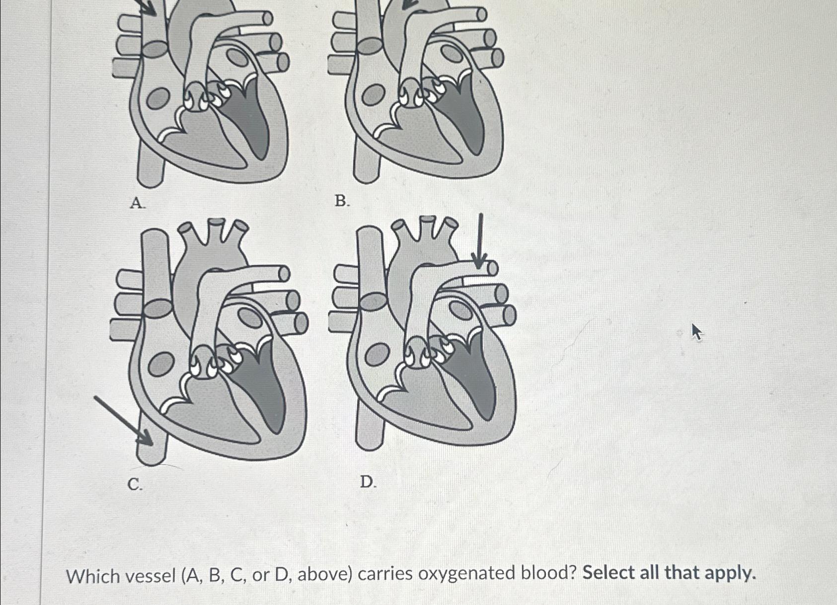 Solved A.C.B.D.Name the vessels above. Which vessel (A, ﻿B, | Chegg.com