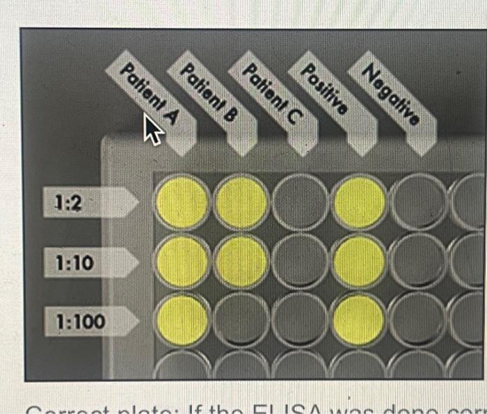 Solved After performing the ELISA, if you dilute a patient's | Chegg.com