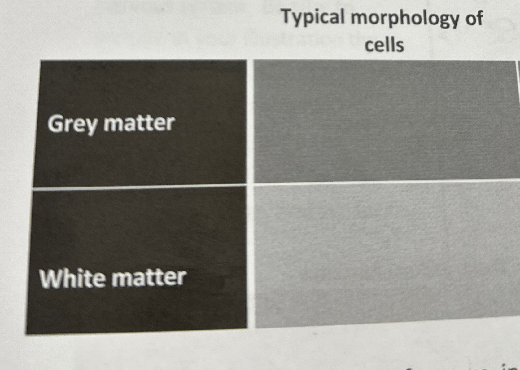 Solved Typical morphology of cellsGrey matterWhite matter | Chegg.com