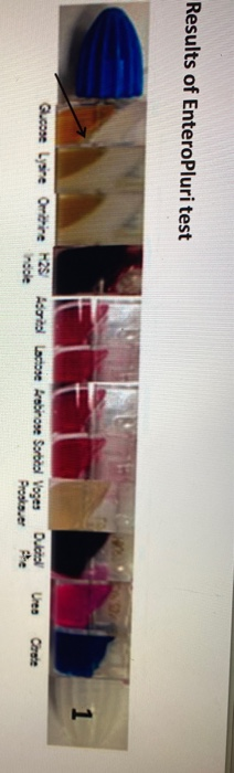 Results of EnteroPluri test 1 Gucose Lysine Omierine | Chegg.com