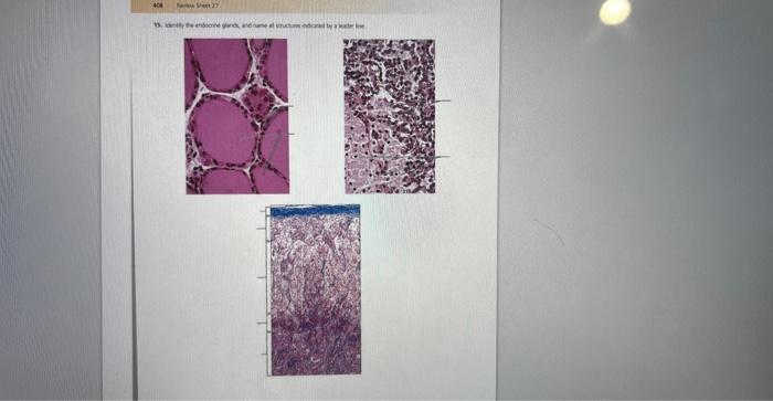 Solved 15. Identify the endocrine glands, and name al | Chegg.com