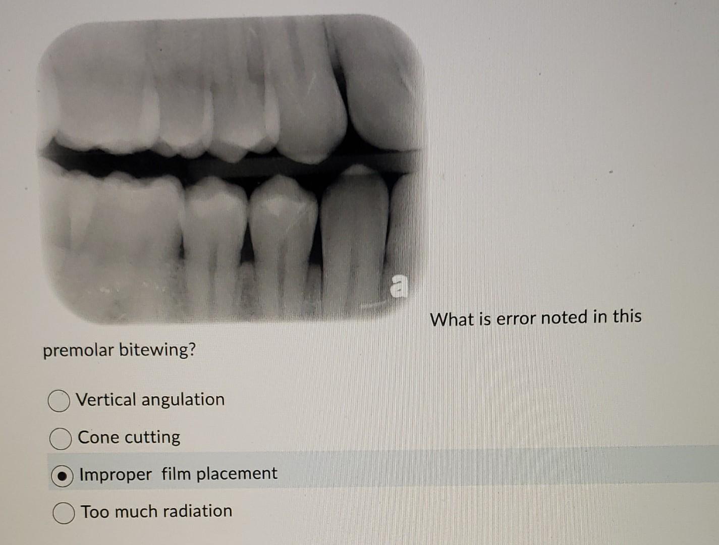 Solved In the picture below, which bite block is disposable, | Chegg.com