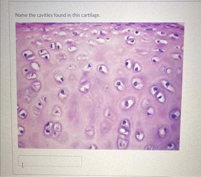 Solved Name the cavities found in this cartilage. | Chegg.com