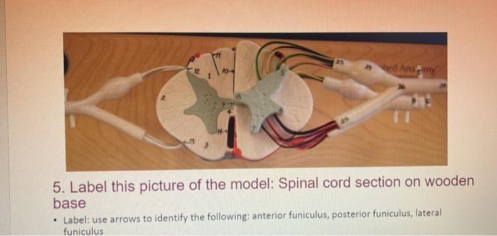 Solved 4. Label this picture of the model: Spinal cord | Chegg.com