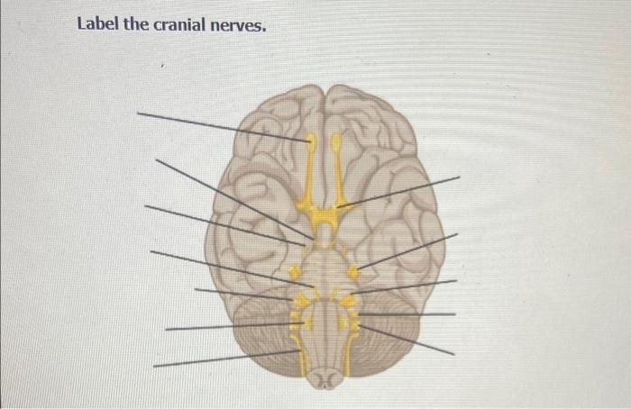 Solved Label the sulci, gyri, and lobes of the cerebrum. | Chegg.com