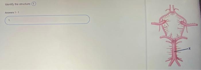 Solved Identify the structure Answers 1 - 1 1 | Chegg.com