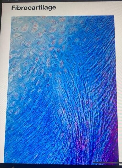 Solved Fibrocartilage | Chegg.com