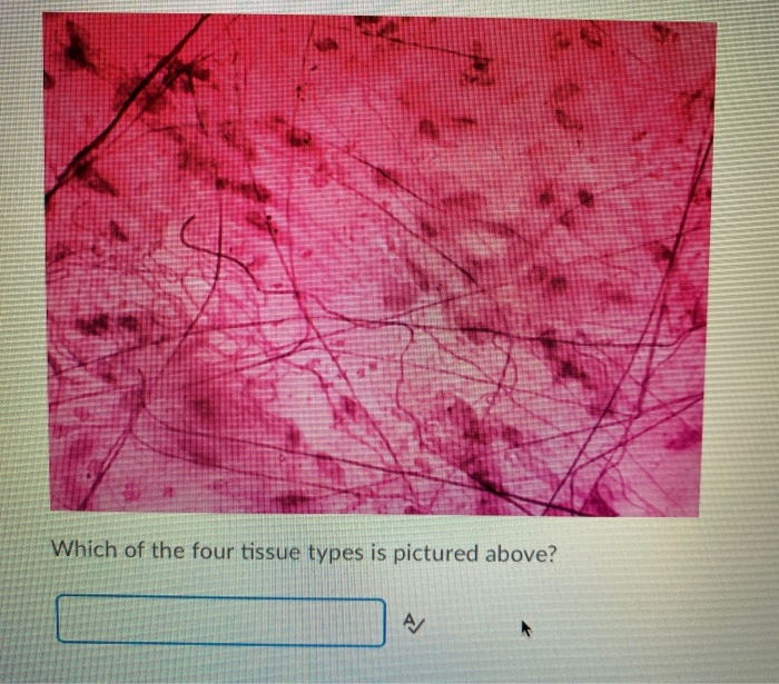 Solved Which of the four tissue types is pictured above? A | Chegg.com