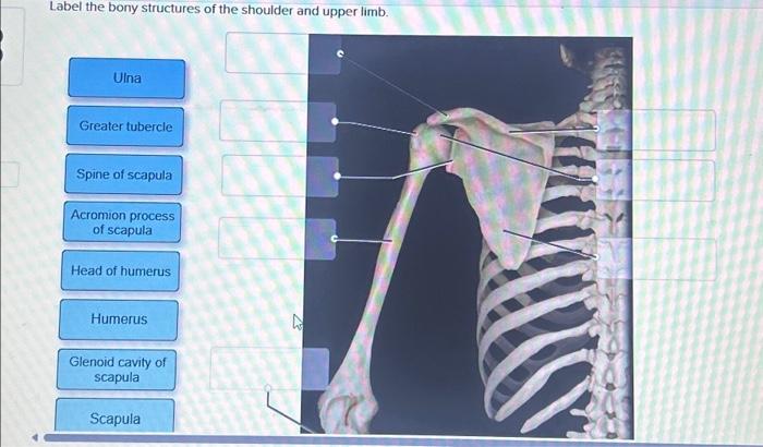 Solved Label the bony structures of the shoulder and upper | Chegg.com