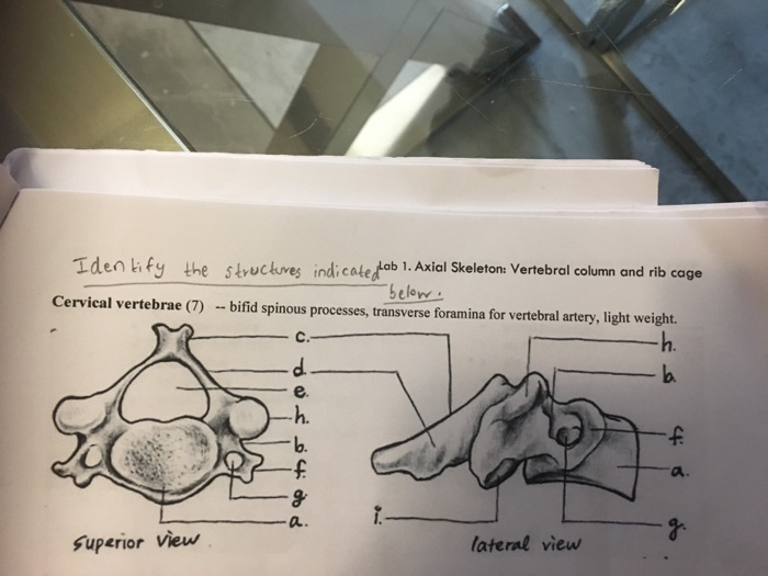 Solved Identify the structures indicate ab 1. Axial | Chegg.com