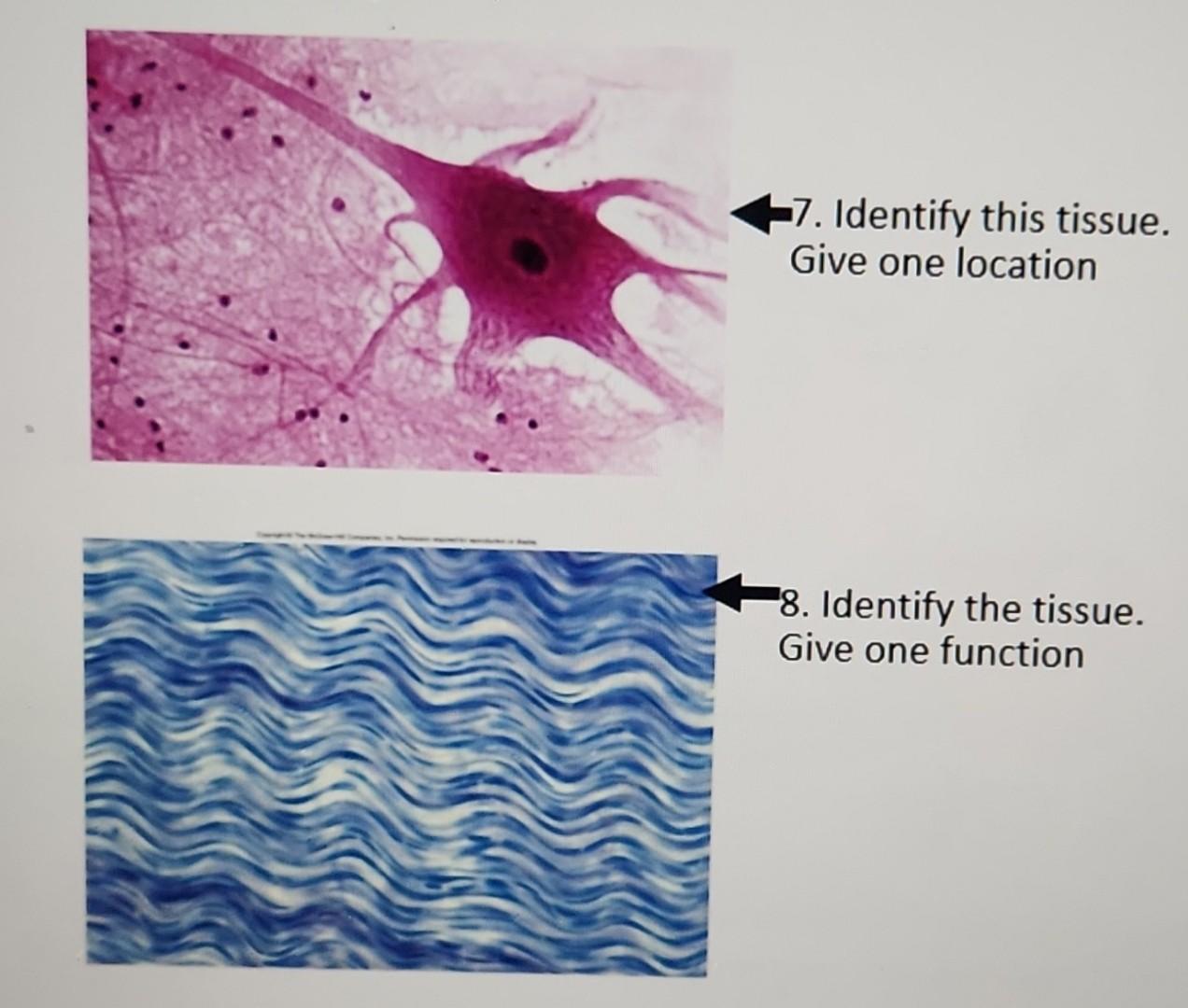 Solved 7. Identify this tissue. Give one location 8. | Chegg.com
