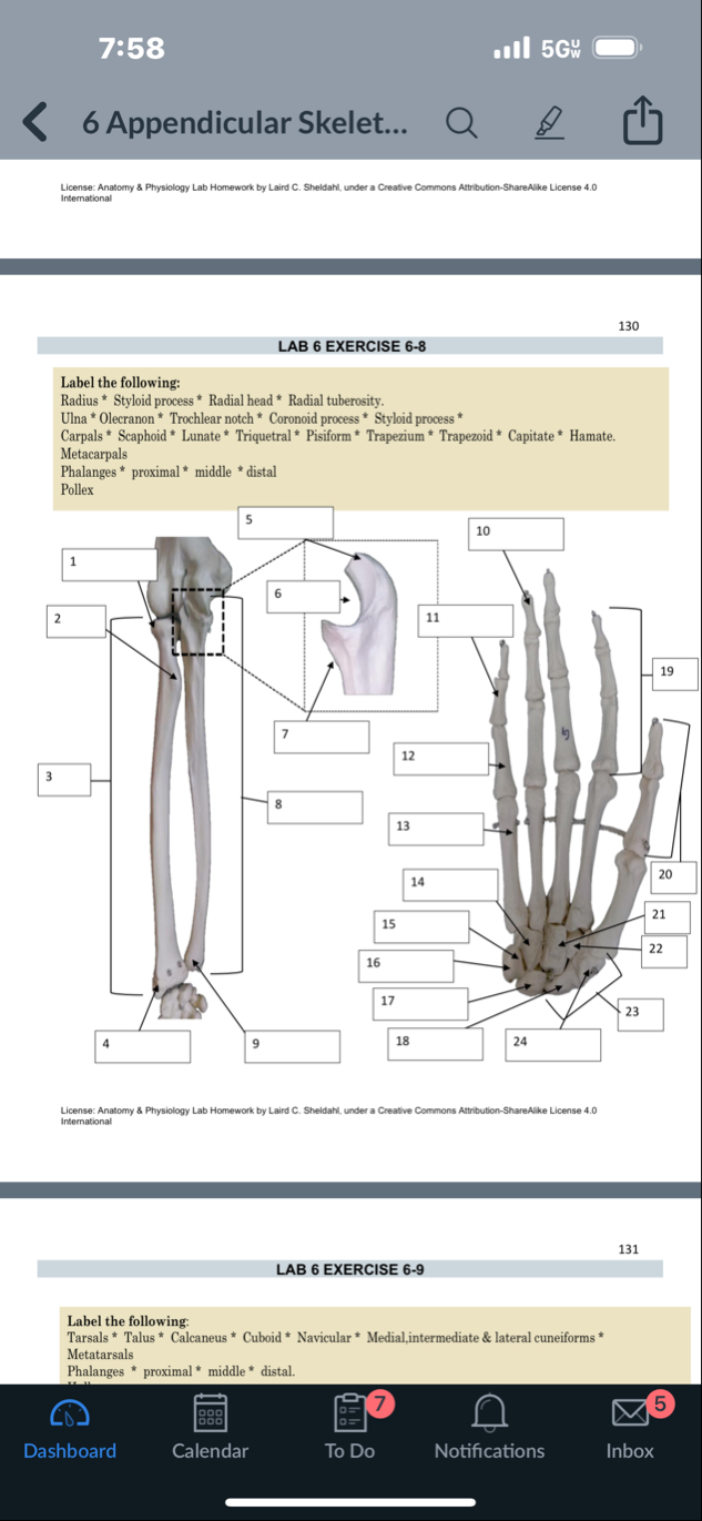 Solved 7:58.וl 5Gw6 ﻿Appendicular Skelet...License: Anatomy | Chegg.com