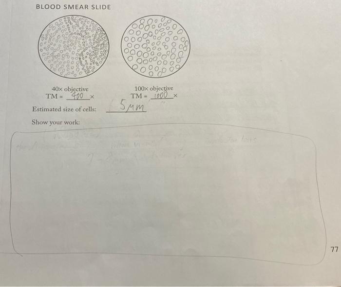Solved BLOOD SMEAR SLIDE OS 40x objective TM = 400 x x 100x | Chegg.com