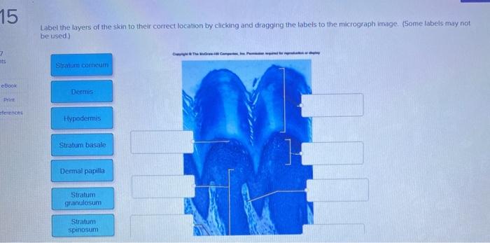 15 Label the layers of the skin to their correct | Chegg.com