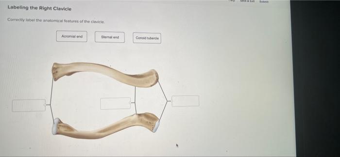 [Solved]: Labeling the Right Clavicle Correctly label the a