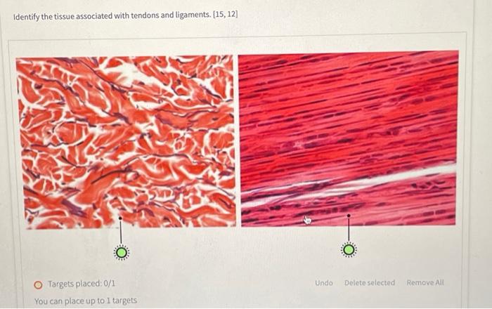 Solved Identify the tissue associated with tendons and | Chegg.com