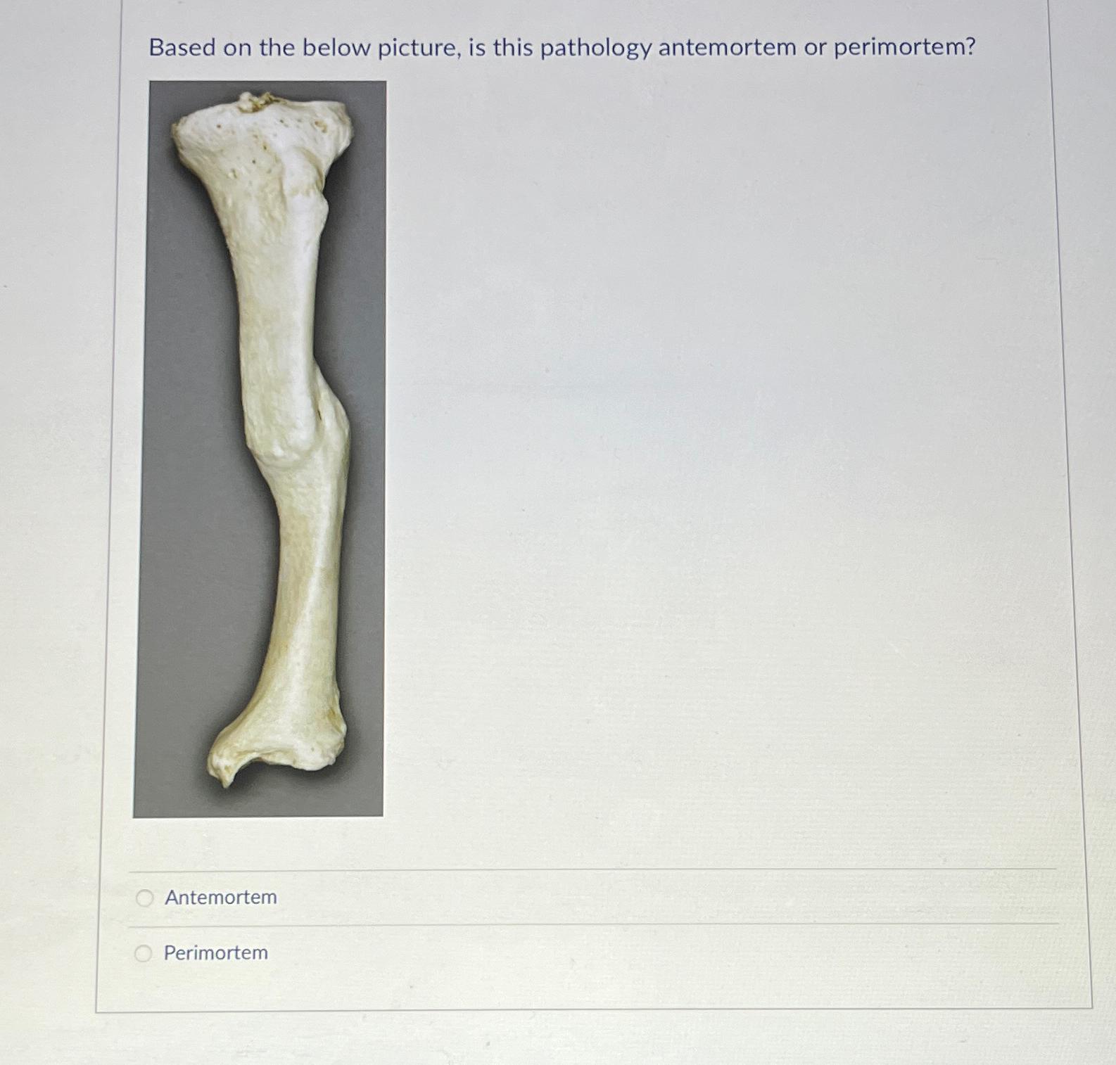 Solved Based on the below picture, is this pathology | Chegg.com
