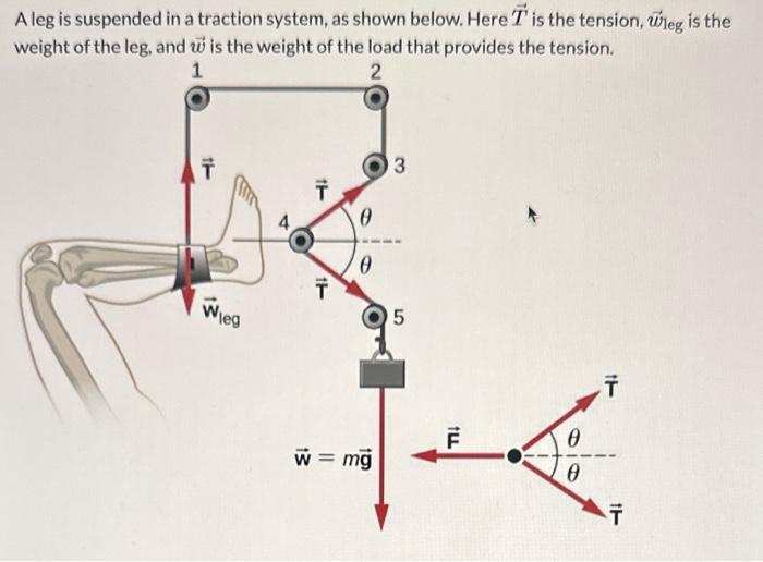 Solved A leg is suspended in a traction system, as shown | Chegg.com