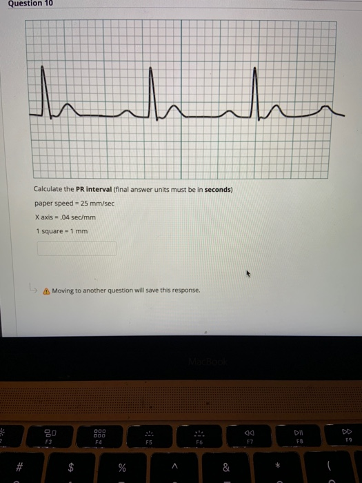 Solved Question 10 المال Calculate the PR interval (final | Chegg.com