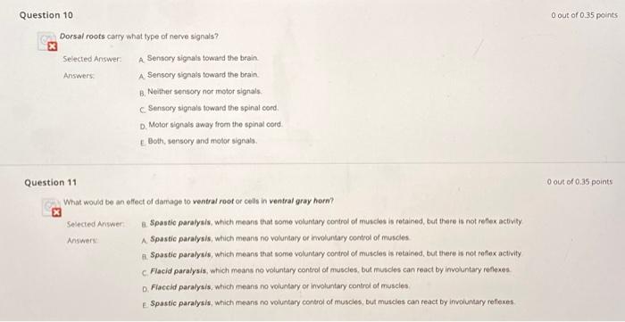 Solved Dorsal roots carty what type of nerve signals? | Chegg.com