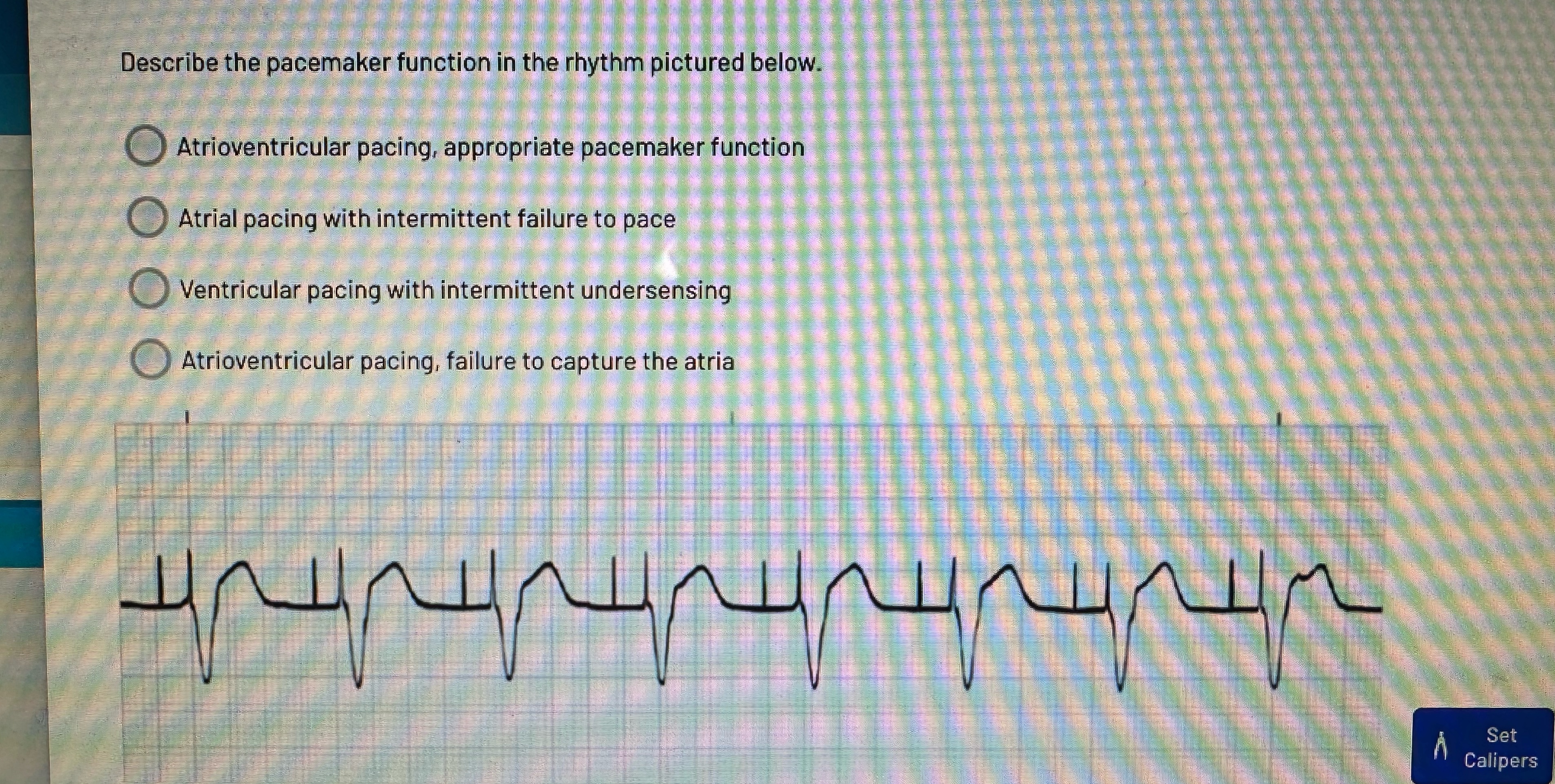 Solved Describe the pacemaker function in the rhythm | Chegg.com