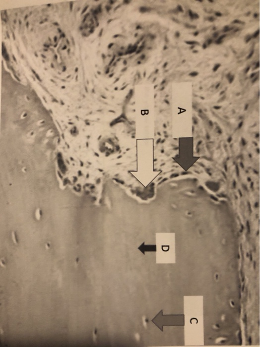 Solved с A 1 D B с A D B secretion of bony matrix | Chegg.com