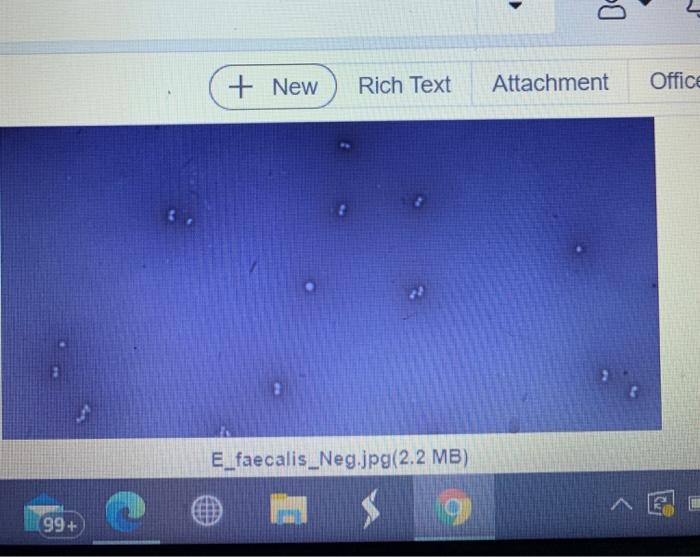 Solved Negative stain slides: You will see the name of the | Chegg.com