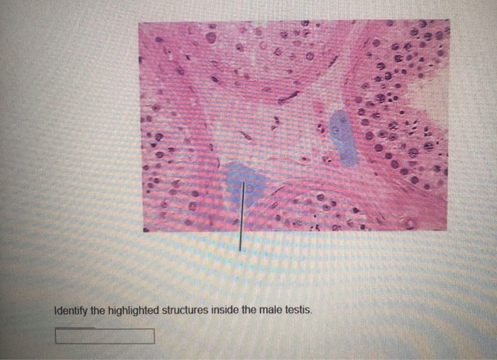 Solved © Identify the highlighted structure inside the | Chegg.com