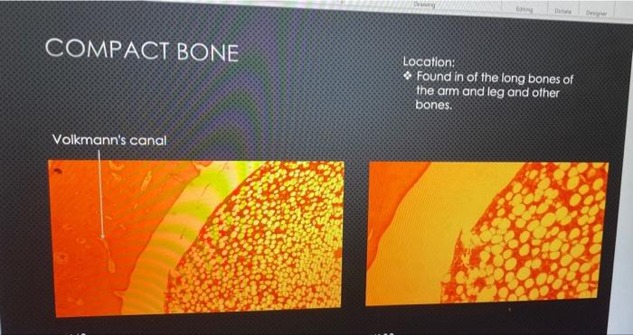 Solved RETICULAR Location: Reticular connective tissue is | Chegg.com