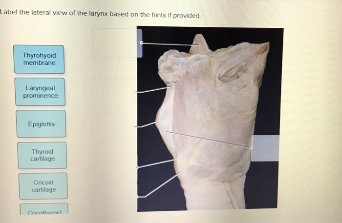 Solved Label the lateral view of the larynx based on the | Chegg.com
