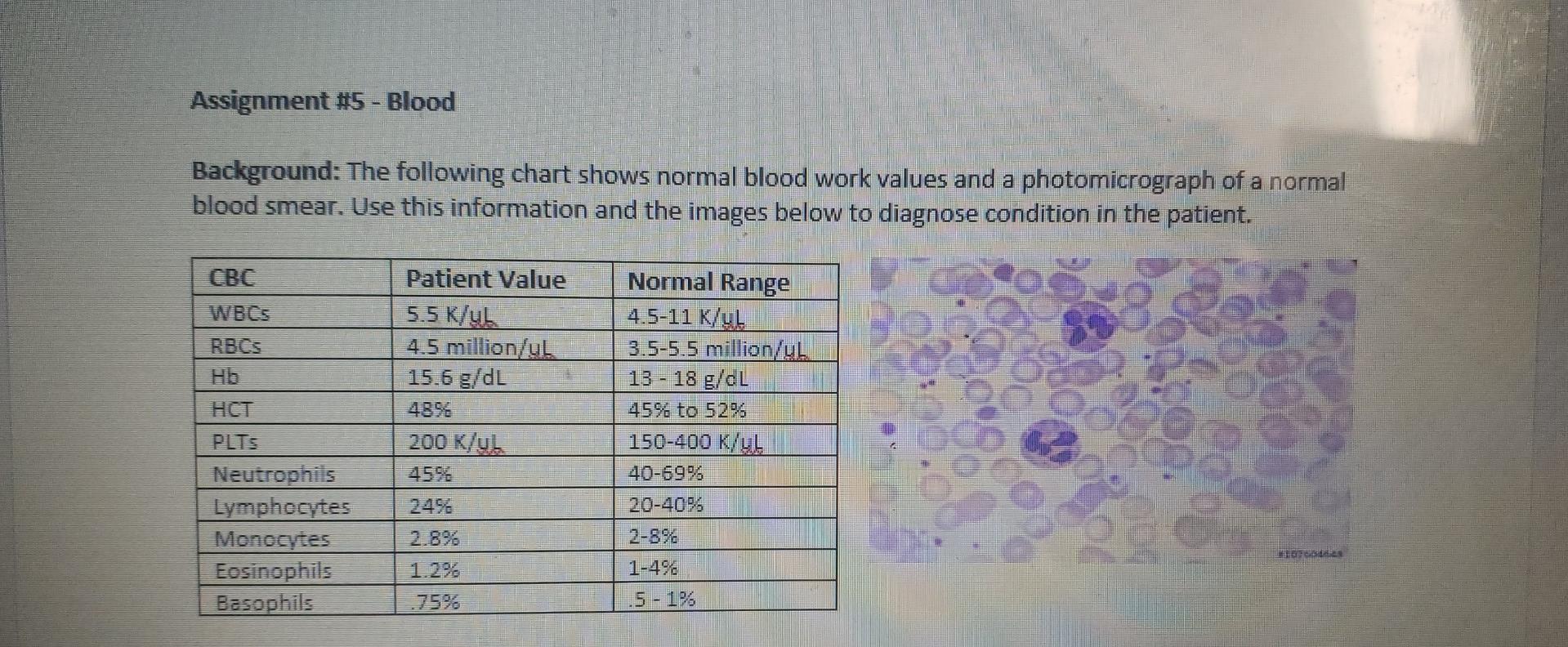 Solved Assignment #15 - Blood Background: The following | Chegg.com